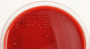 Environmental Isolate Case File: Moraxella osloensis - Microbiologics Blog