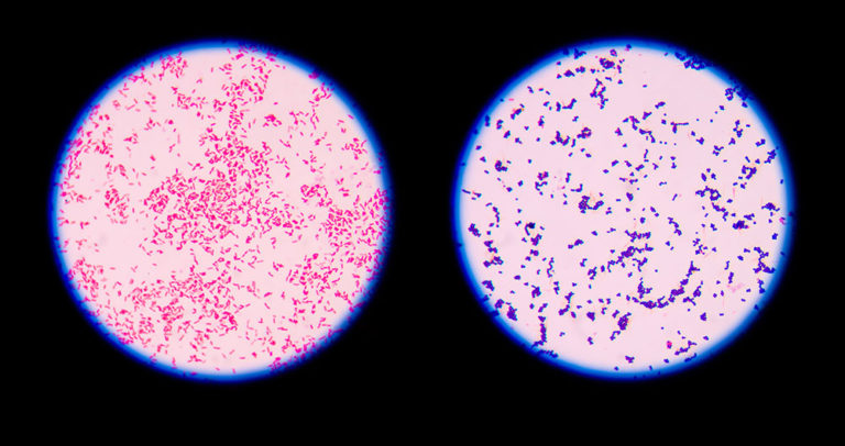9 Gram Staining Best Practices - Microbiologics Blog